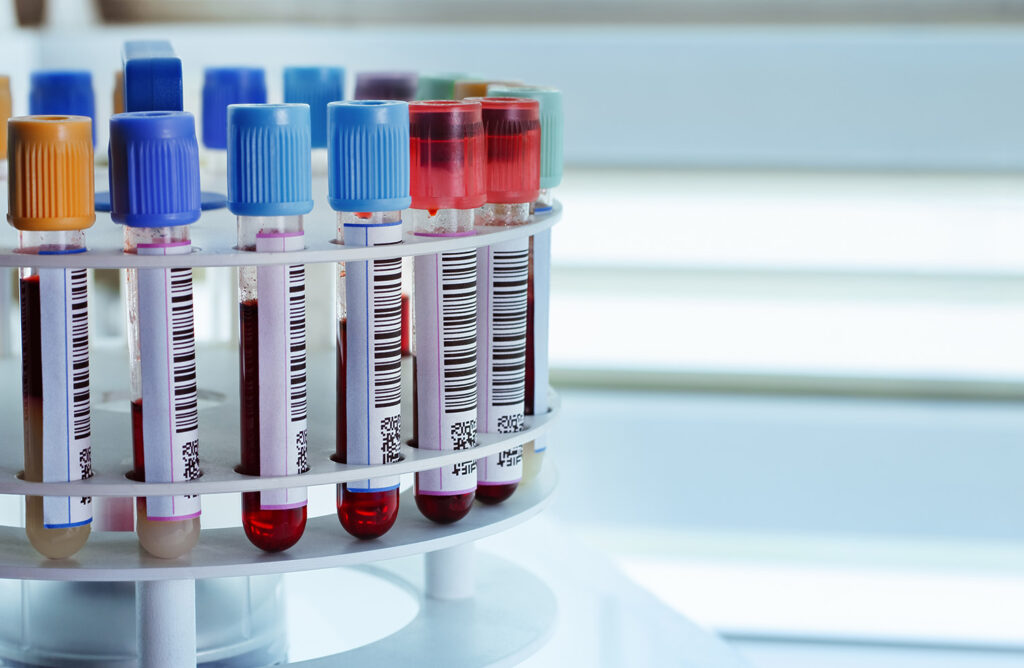 FDA Guidance on Medical Device Patient Labeling: Readability | RegDesk FDA Guidance on Medical Device Patient Labeling: Readability | RegDesk